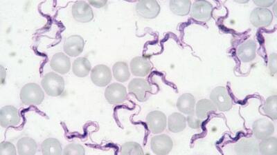 Laboratory Diagnosis of Faecal & Blood Parasites | LSTM