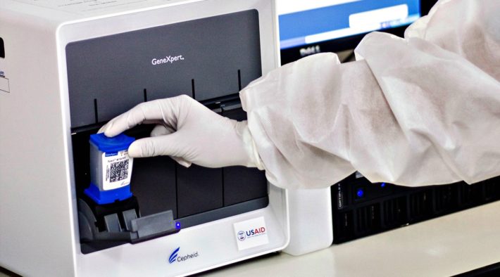 Cochrane review looks at the accuracy of Xpert® MTB/RIF for the ...