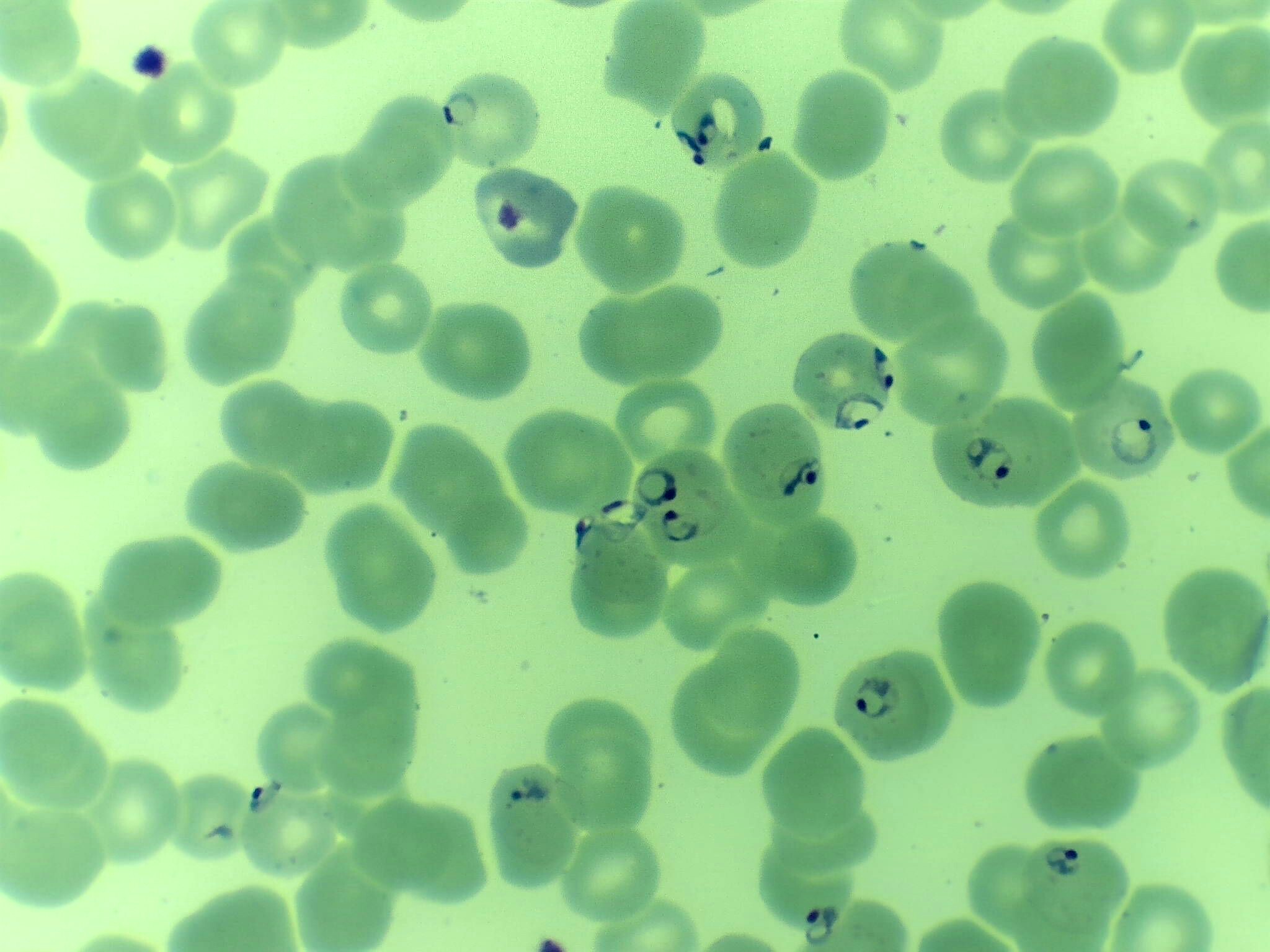 Blood parasites: Malaria | LSTM