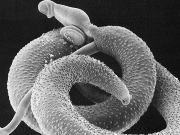 Other diagnostic tests: Schistosomiasis | LSTM