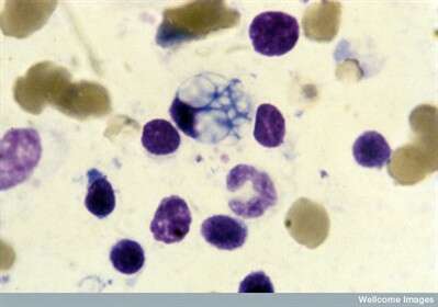 leishmania slide